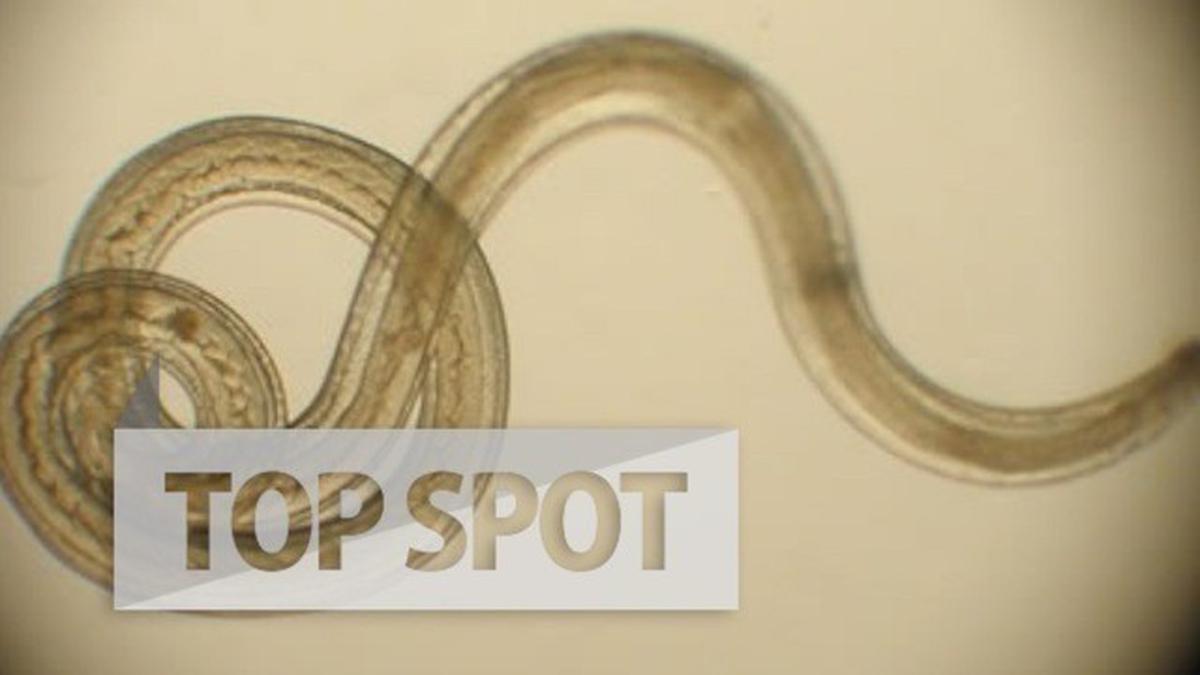 6 Tanda Tubuh Anda Dimakan Parasit Hidup-hidup - Video Liputan6.com