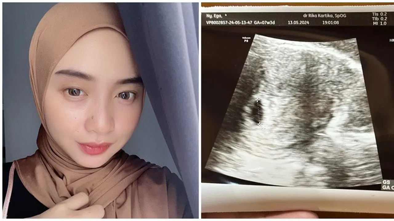 6 Potret Terbaru Ega Noviantika DA, Umumkan Hamil Anak Ketiga di Usia ...