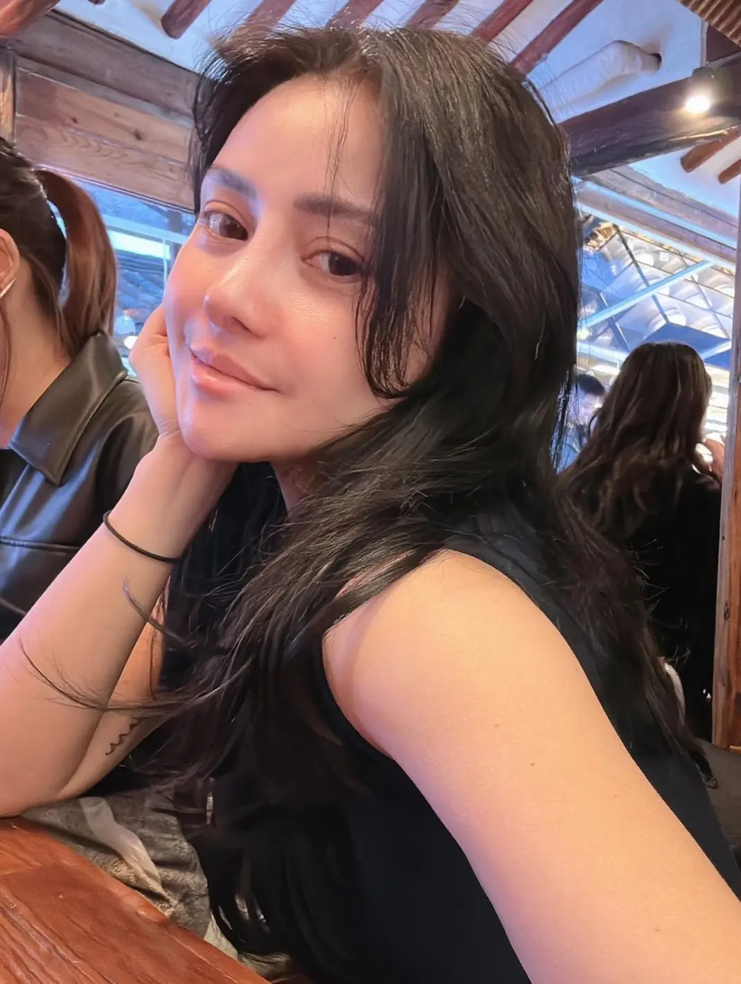 10 Potret Before - After Mawar AFI yang Beberapa Kali Operasi Plastik ...