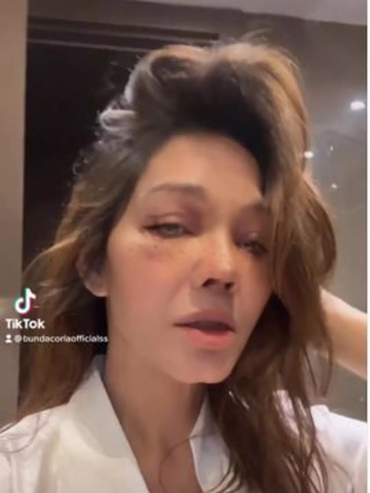 Bunda Corla Operasi Plastik, Ini 6 Potretnya dengan Perban dan Wajah ...