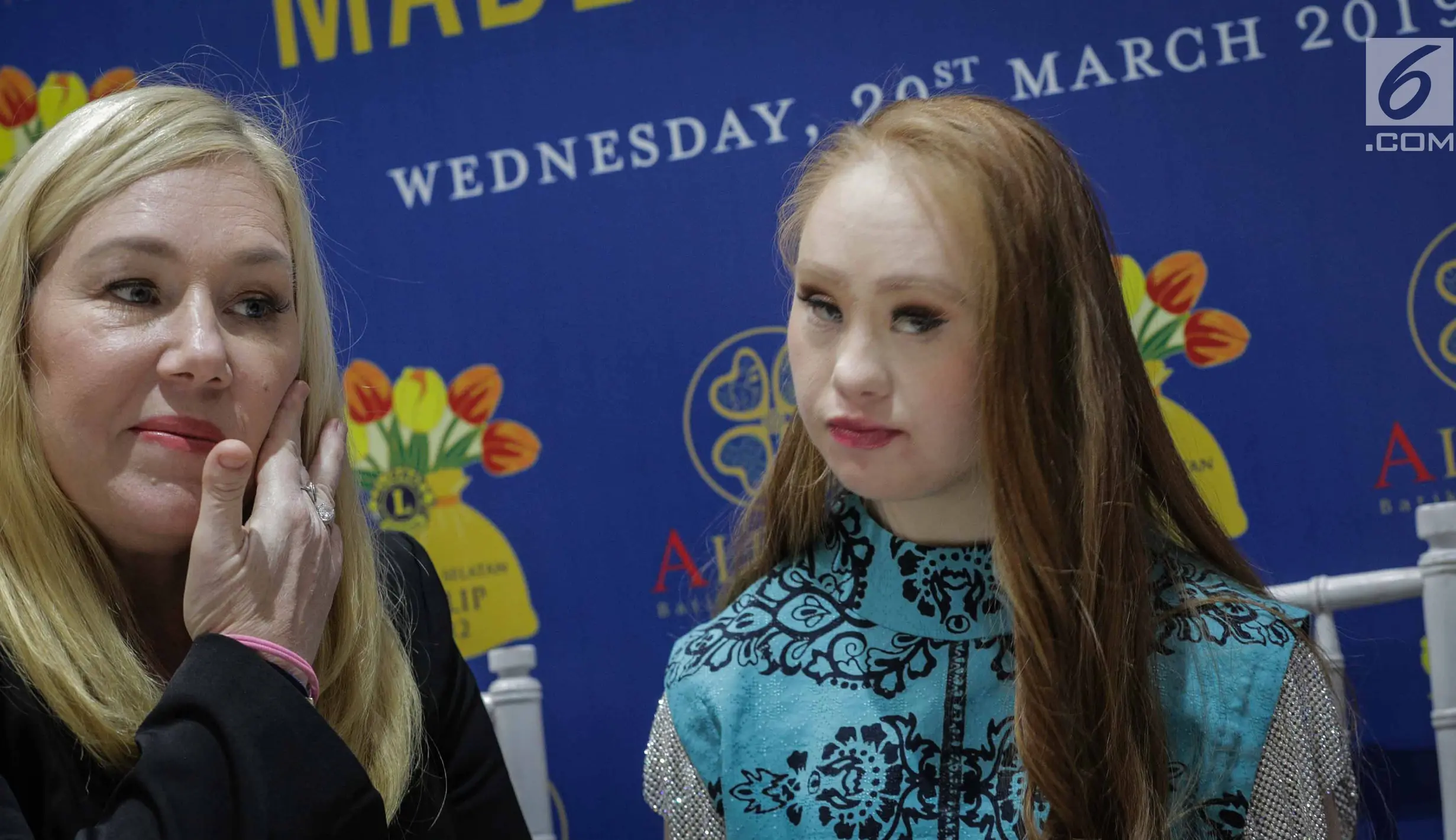 FOTO: Mengenal Madeline Stuart, Model Down Syndrome Asal Australia ...