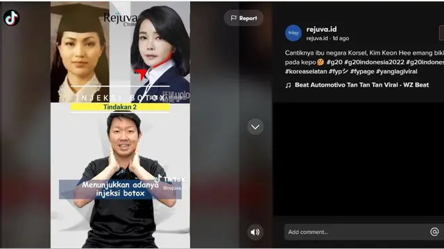 Dokter Klinik Kecantikan Bongkar 3 Operasi Plastik yang Dilakukan Ibu Negara Korsel - Citizen6 ...