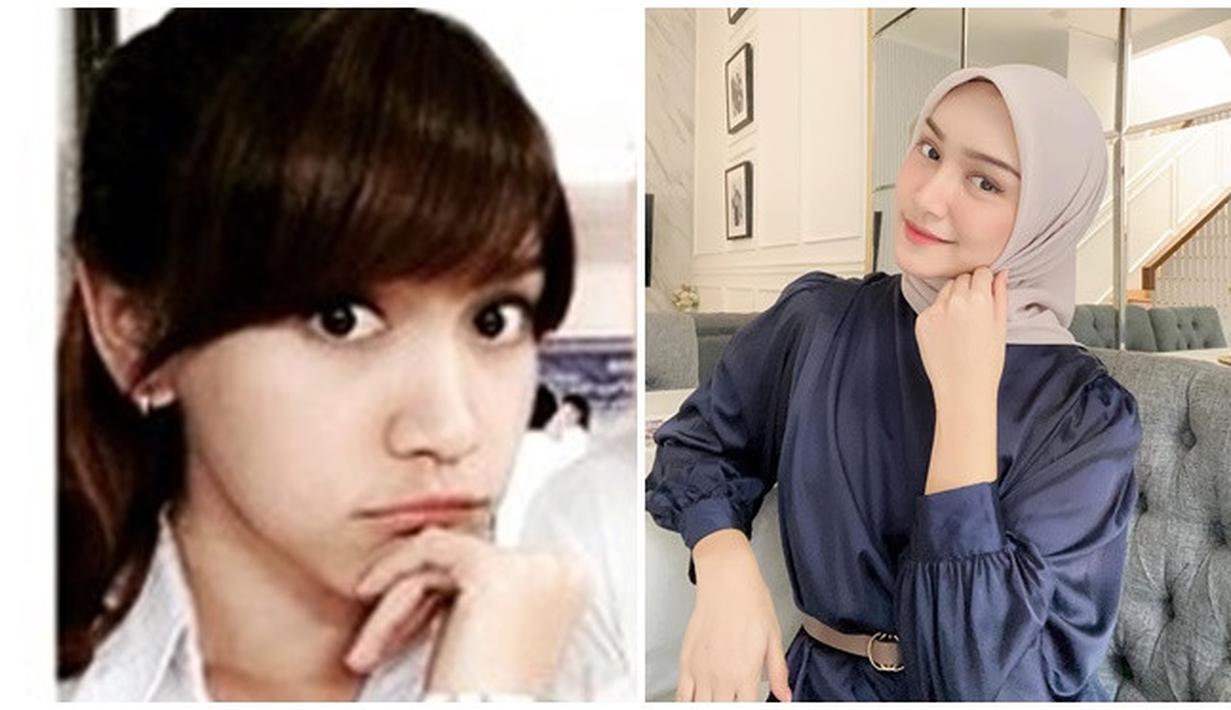 Potret Dulu Vs Kini Pemain Sinetron ABG Jadi Manten, Melody Prima Bikin ...