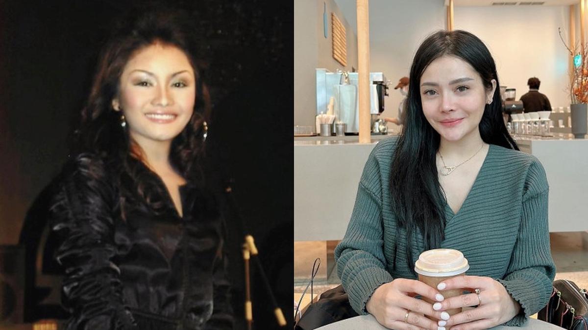 10 Potret Before - After Mawar AFI yang Beberapa Kali Operasi Plastik ...