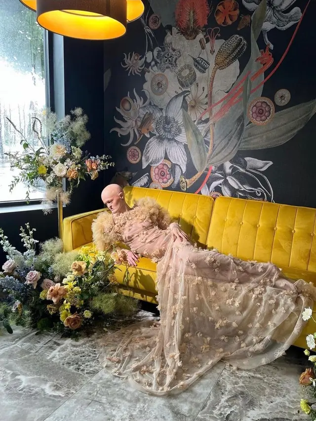 Jadi Model Terkenal Meski Alami Kelainan Genetik Langka, Wanita Ini ...