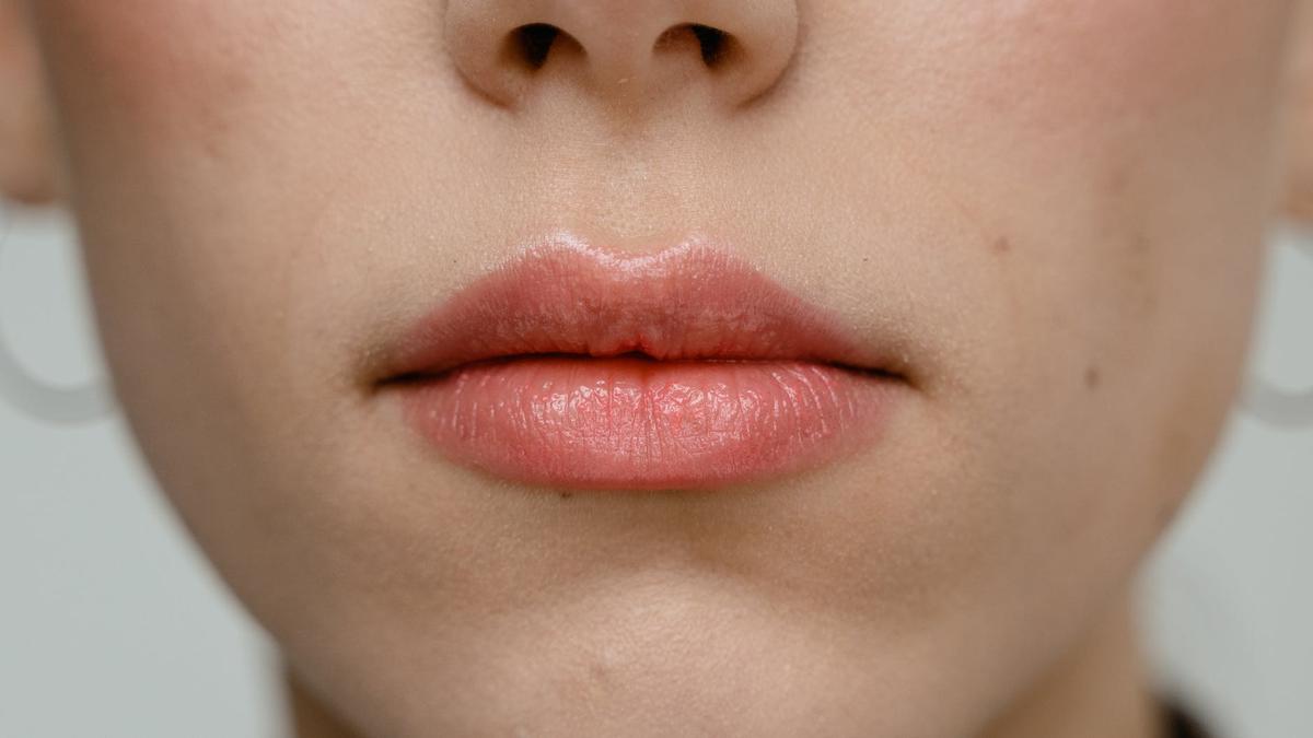 Perhatikan Nih Faktor Penyebab Hiperpigmentasi Bibir Menurut Dokter Kulit