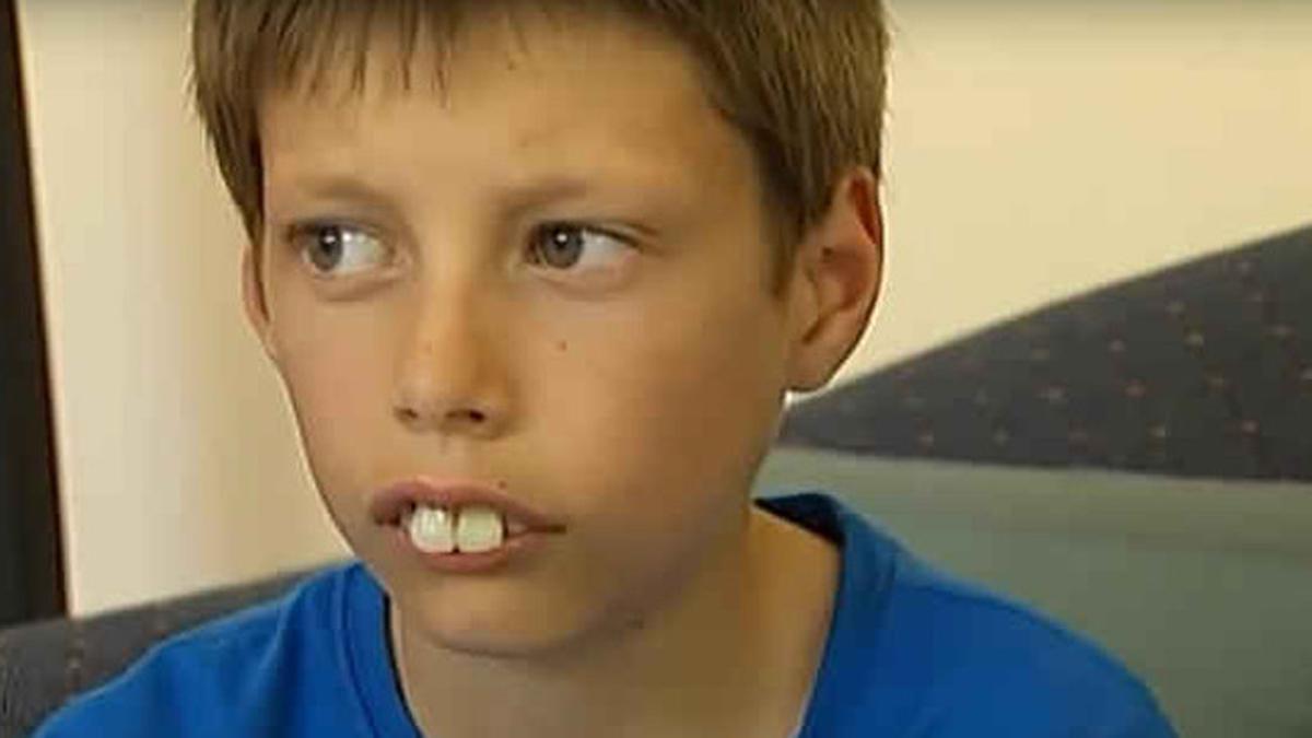 Kisah Metamorfosis Si Gigi Kelinci Jadi Cowok Ganteng - Citizen6 ...