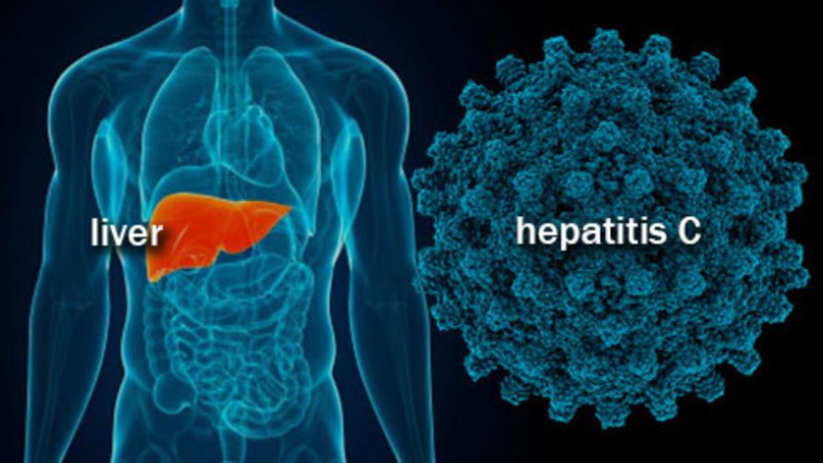 Kini Ada Obat Hepatitis C Terbaru yang Efektif dan Terjangkau