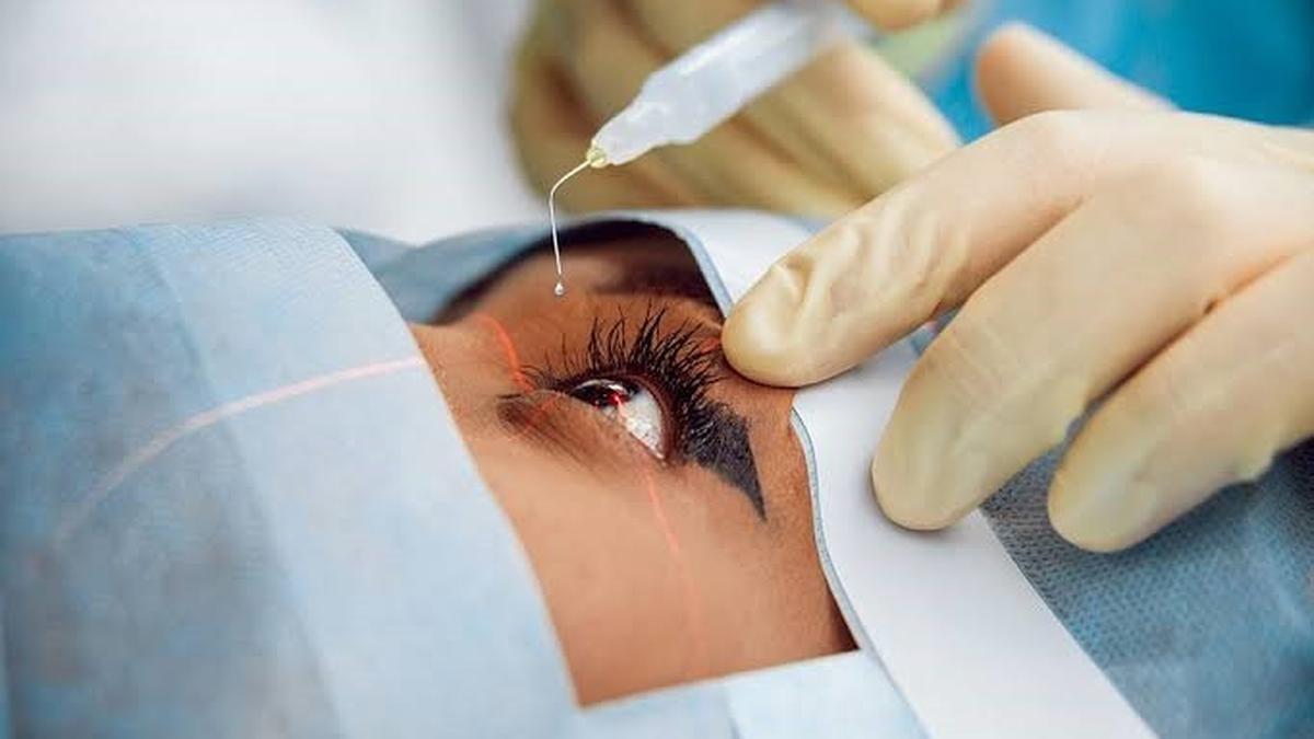 Dokter Bedah di AS Lakukan Transplantasi Mata Utuh Pertama di Dunia ...