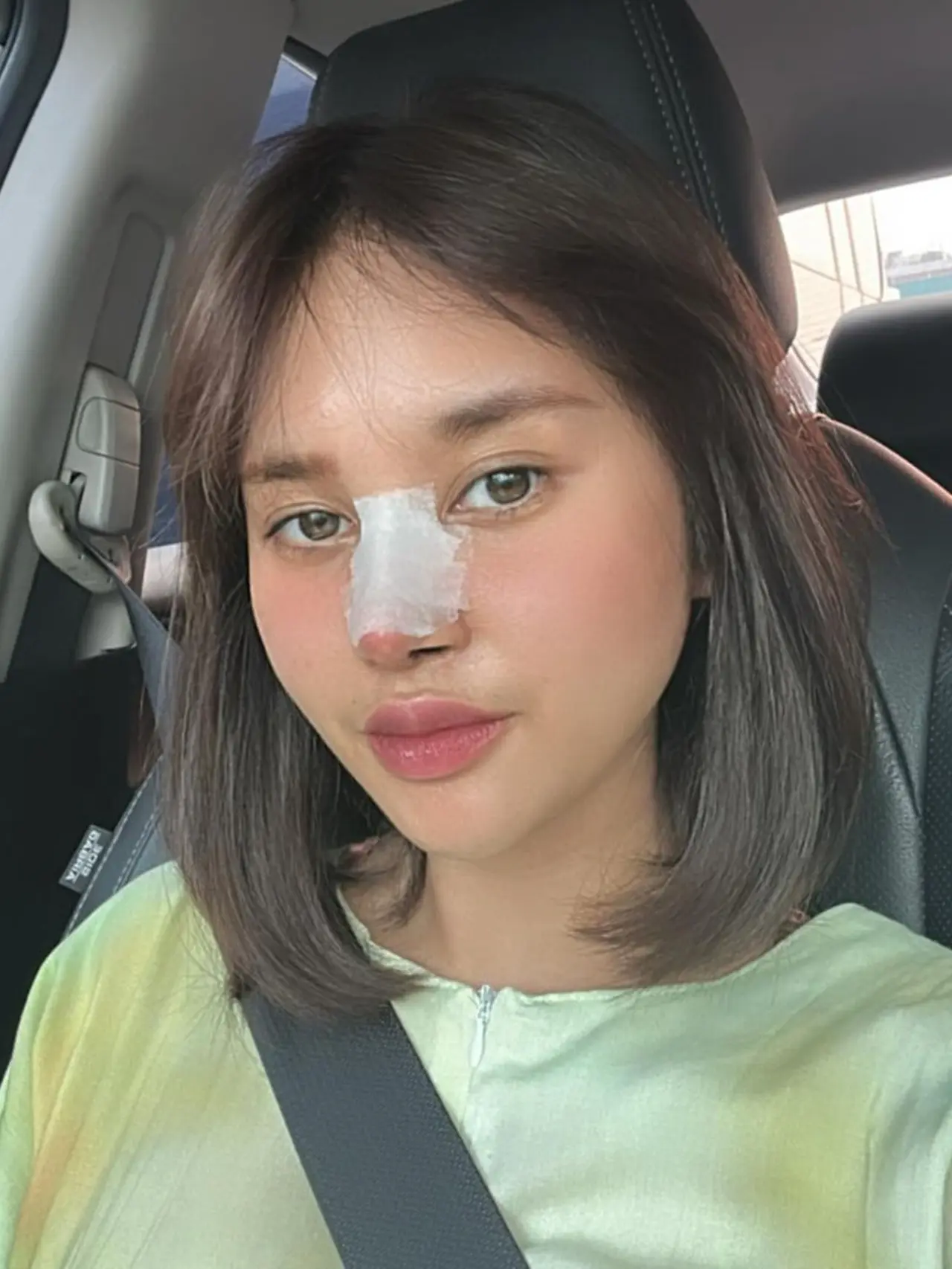 6 Potret Permesta Dhyaz Anak Farida Nurhan Oplas Hidung Lagi, Dulu ...