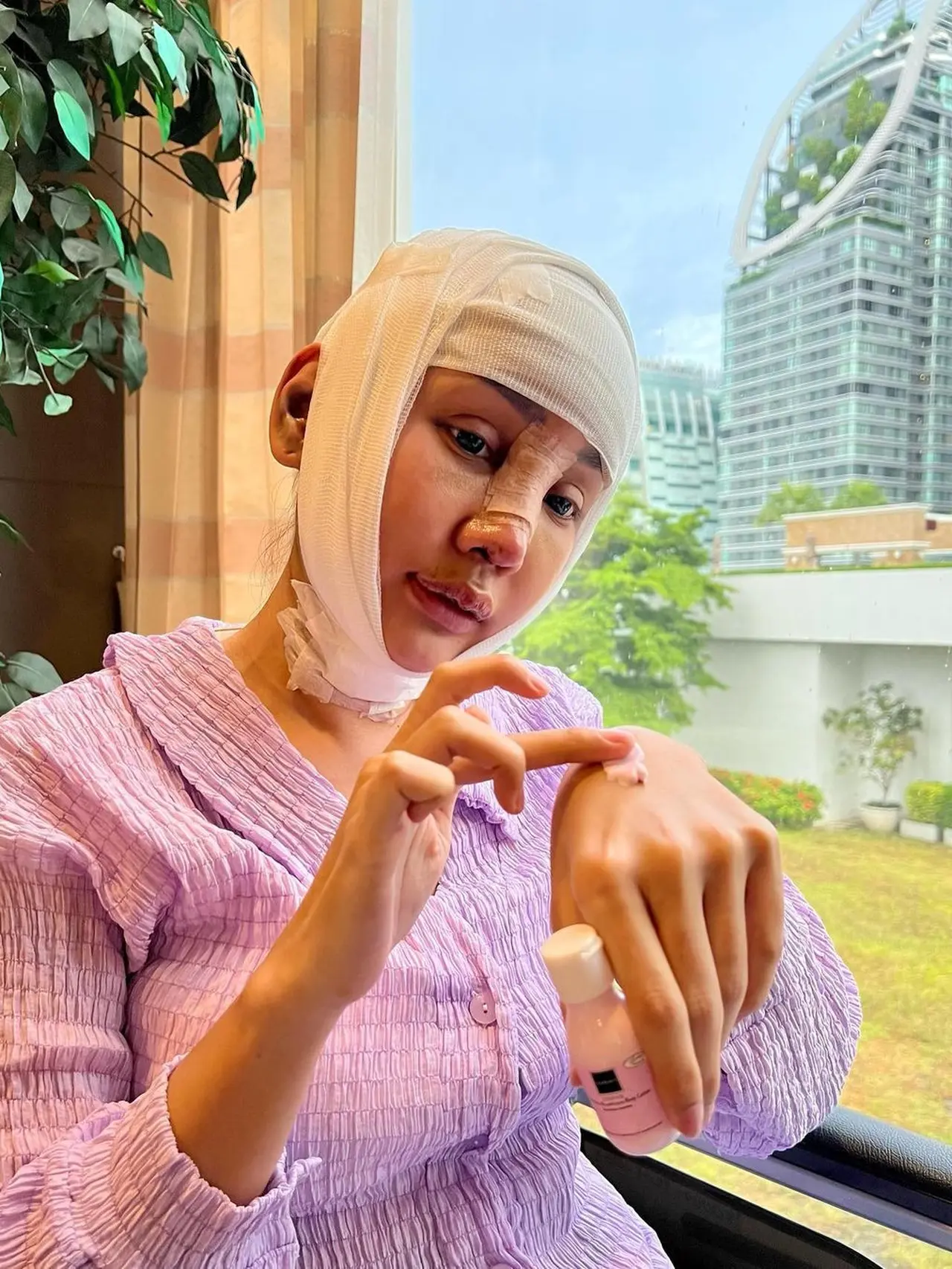 7 Potret Lucinta Luna Kembali Jalani Operasi Plastik, Bikin Geleng ...