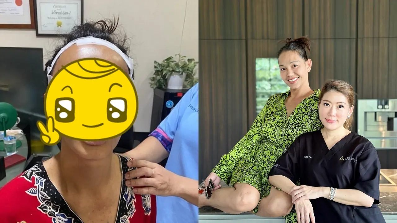 6 Potret Wajah Bunda Corla Lebam Usai Oplas Rp 1.5 Miliar, Disebut ...