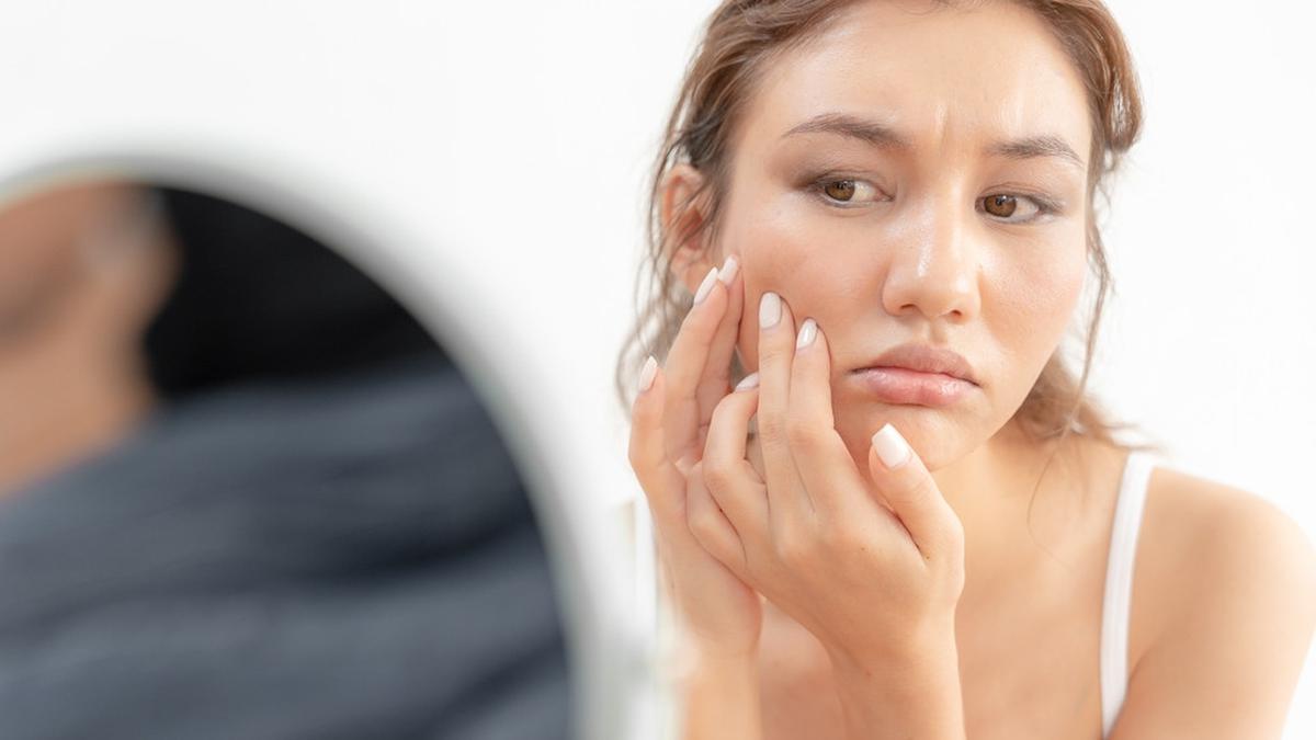 6 Faktor Utama yang Memicu Pori-Pori Besar dan Cara Alami Mengatasinya ...