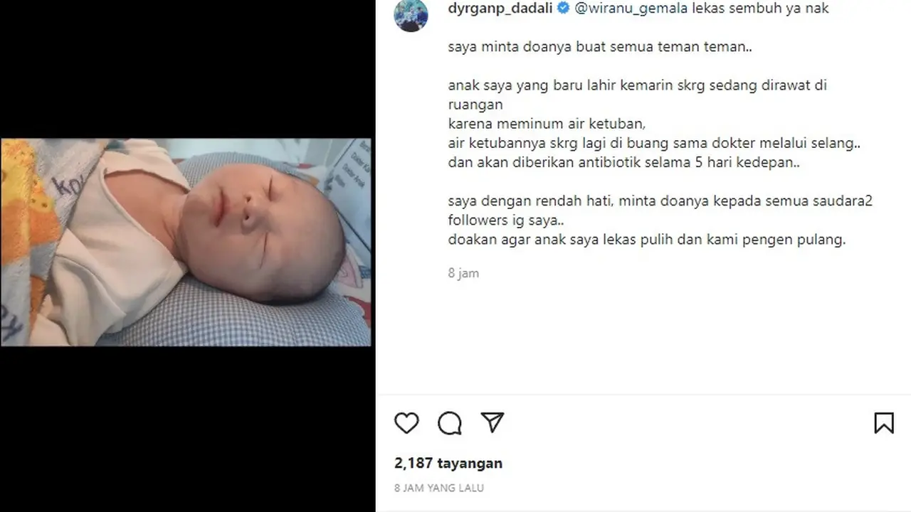 Bayi Dyrga Dadali yang Baru Lahir Minum Air Ketuban Kini Harus Jalani ...