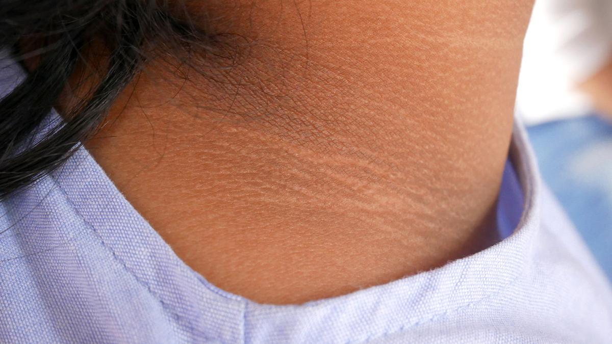 7 Cara Mencerahkan Area Leher dengan Bahan Alami, Mudah Dipraktikkan